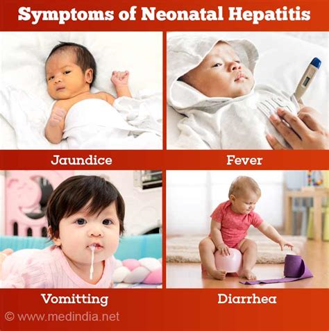 Neonatal Hepatitis Causes Symptoms Complications Diagnosis