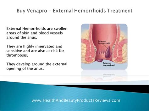 Buy Venapro External Hemorrhoids Treatment Ppt