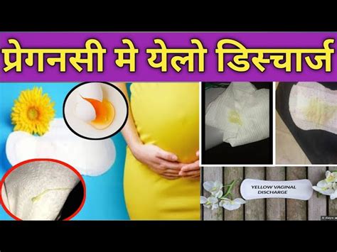 Yellow Odorless Discharge In Early Pregnancy