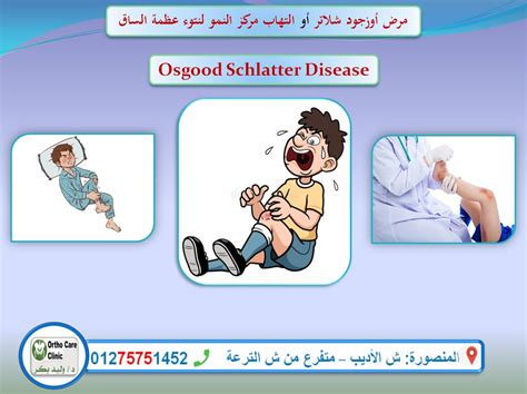 عياداتدوليدبكراستشاريجراحاتالعظاموالمفاصل آلاممفصلالركبة