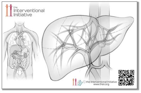 Scratch Pads — The Interventional Initiative
