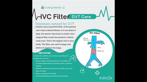 Dvt Ivc Filter Medicalcoding Anatomy Codingtips Youtube