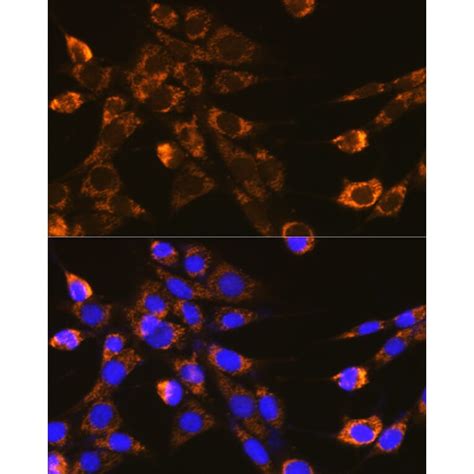 Anti Integrin Beta 1 Antibody A17015