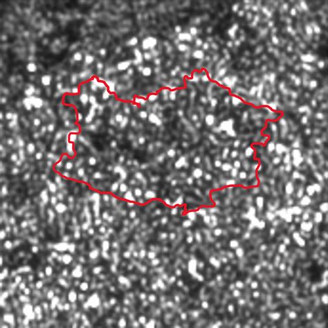 Example Of Vertical Vertical Vv Amplitude Sar Image Anonymization Download Scientific Diagram