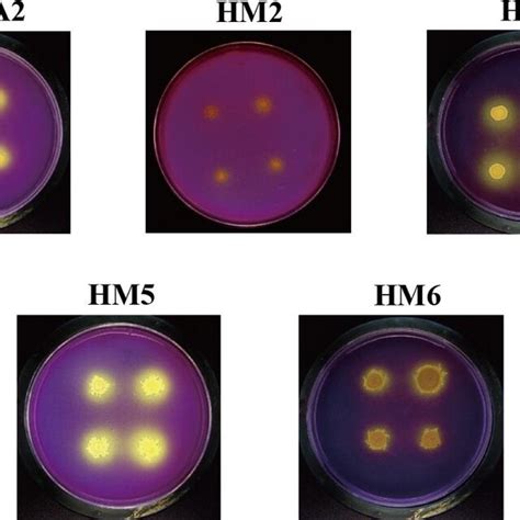 Isolation Of Phosphorus Solubilizing Microorganisms Psms Seven Psms Download Scientific