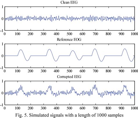Figure 1 From Ocular Artifact Removal From Eeg Using Anfis Semantic Scholar