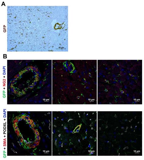 Figure S3 A B The Pdgfrb Promoter Is Active In Both Cardiac Download Scientific Diagram