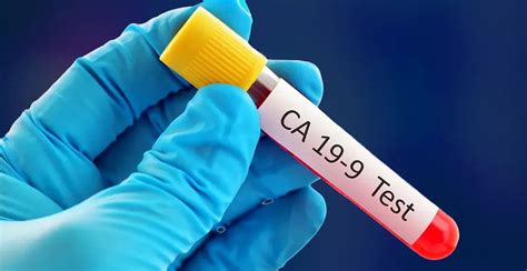 Labanalyzer Ai Powered Lab Results Analysis