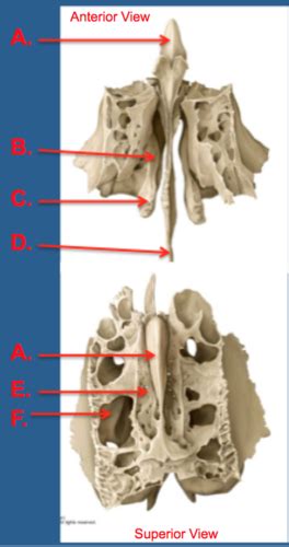 Ethmoid Sphenoid Temporal Bone Flashcards Quizlet