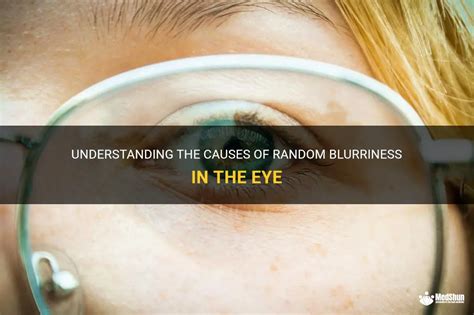 Understanding The Causes Of Random Blurriness In The Eye MedShun