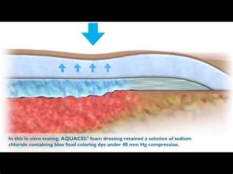 Aquacel Foam Mode Of Action Video How To Use Hydrocolloid Dressing
