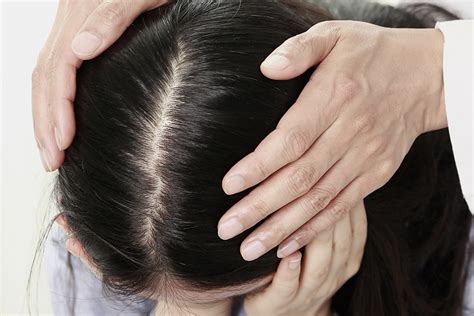 계피부과 Since 1961 탈모클리닉 남성형탈모 계피부과 Since 1961 탈모클리닉 남성형탈모