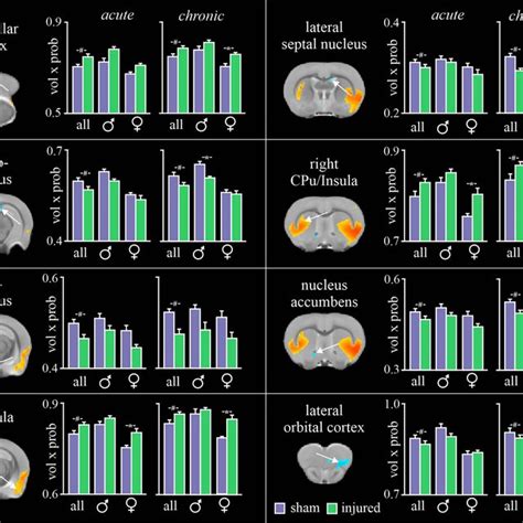 Main Effect Of Sex On Gray Matter Density Changes Plots Of Mean SEM Download Scientific