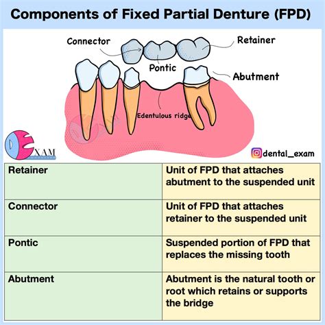 Dental Exam Component Of Fixed Partial Denture Fpd Facebook Dental Exam Component Of Fixed Partial Denture Fpd Facebook