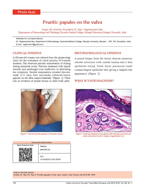 Pruritic Papules On The Vulva Pdf Epidemiology Skin