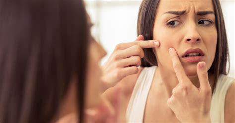 Get Rid Of Spots Blog Manna Feel The Difference On Your Skin