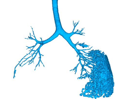 A Representative Result Of The Automatic Airway Segmentation From An