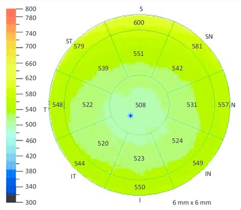 New Methods Topography Pachymetry Map Pentacam The Keratoconus