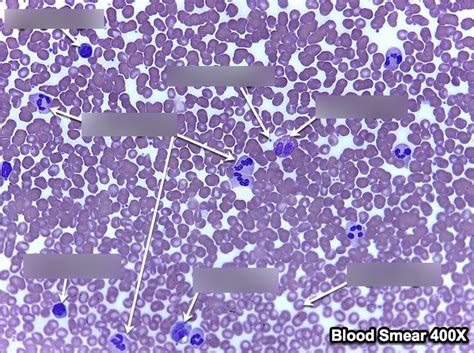 Blood Smear 2 Diagram Quizlet