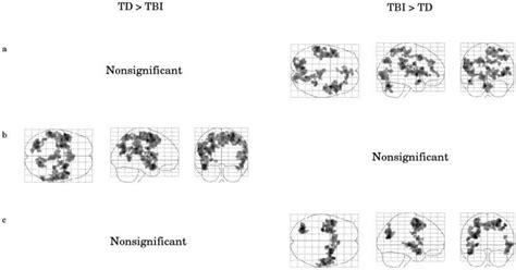Maximum Intensity Projection Maps Of Between Groups Contrasts For A Download Scientific
