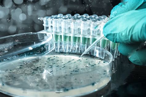Plasmid Dna Isolation Basic Principle And Procedure Howbiotech