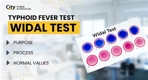 Typhoid Fever And Widal Test Purpose And Normal Range