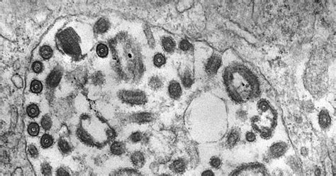 Cdc Issues Warning About Deadly Marburg Virus Amid Outbreaks In Africa