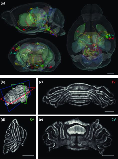 2 Mapping Brain Wide Anatomy A Tracing Of Long Distance Projecting Download Scientific