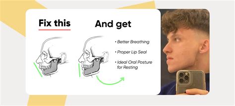 Forward Facial Growth The Comprehensive Guide Ach