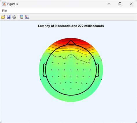 Eeg Analysis Filtering