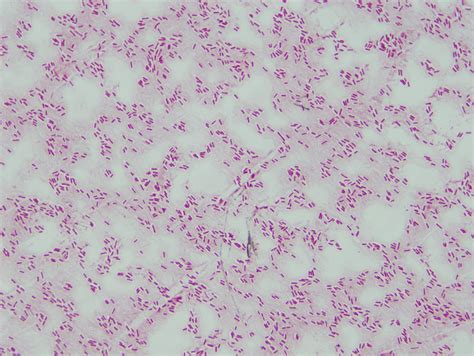 Gram Stain Pseudomonas Aeruginosa Pseudomonas Aeruginosa Gram Stain Of