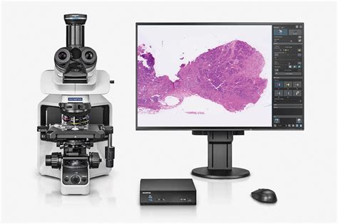 Dp28 Microscope Digital Camera Omnibus Bio Medical Systems Inc