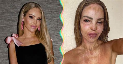 Ive Reached The End Of The Road” Katie Piper Shares A Bright Update