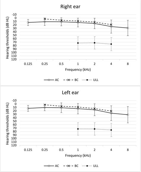 Figure 1 From Hyperacusis Assessment Questionnaire—a New Tool Assessing Hyperacusis In Subjects