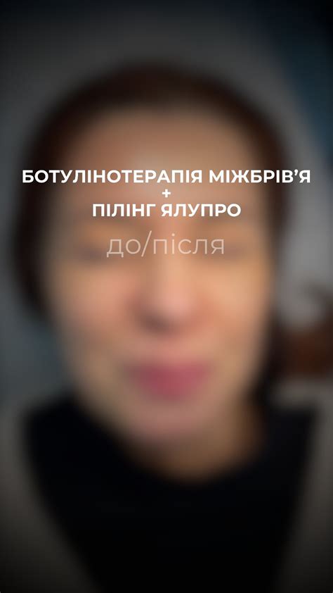 Лазерна Епіляція Дерматологія Масаж Боярка Self Beautyhouse • Instagram Photos And Videos