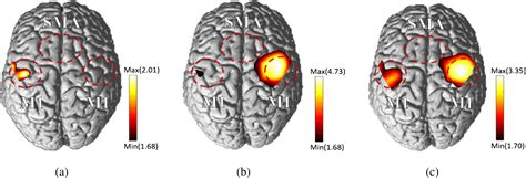 Optonet A Matlab Based Toolbox For Cortical Network Analyses Using Functional Near Infrared