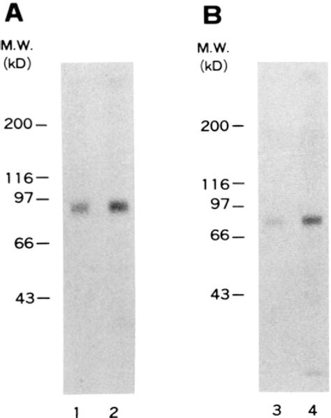 Figure From Identification Of The Platelet Specific Alloantigen Naka On Platelet Membrane