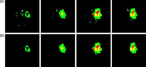 post‐processing results a segmented image before post‐processing and