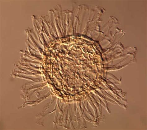The Oldest Fossils Of Eukaryotes Have Been Estimated To Be Josuekruwcarlson