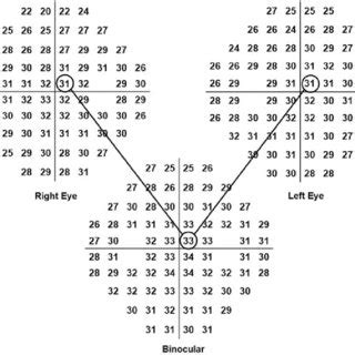 A Schematic Diagram Describing The Binocular Simulation Technique Using Download Scientific