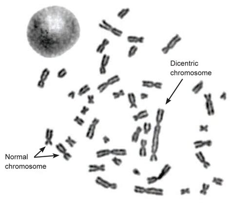 Photomicrograph Of A Metaphase Spread Used For The Dicentric Chromosome