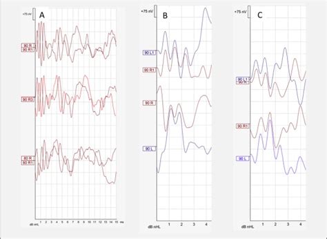 Cochlear Microphonics And Auditory Brainstem Responses To Condensation