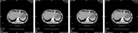 Figure 3 From Super Spatial Structure Prediction Compression Of Medical Semantic Scholar