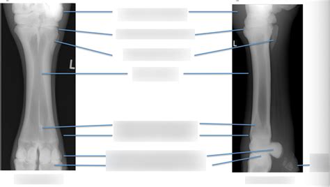 Bovine Metacarpus Dp And Lm Diagram Quizlet