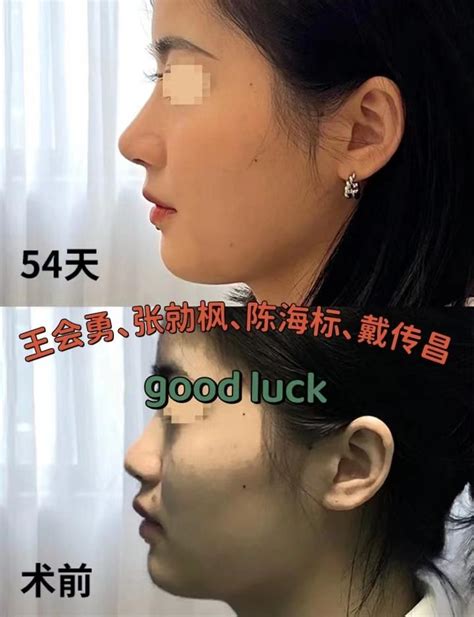 上海妈生鼻专家：王会勇、张勍枫、陈海标、戴传昌亲身实测 知乎