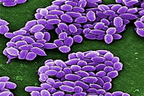 Nigeria Confirms First Case Of Anthrax The Nation Newspaper