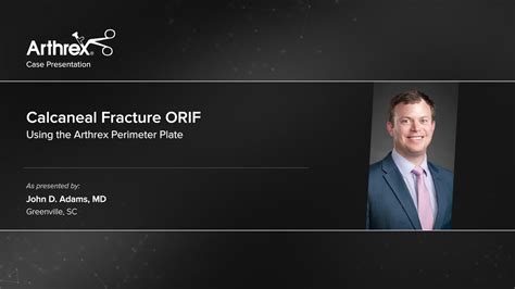 Arthrex Calcaneal Fracture Orif Using The Arthrex Perimeter Plate