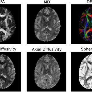 Diffusion Tensor Based Scalar Maps Created With Dipy Download Scientific Diagram