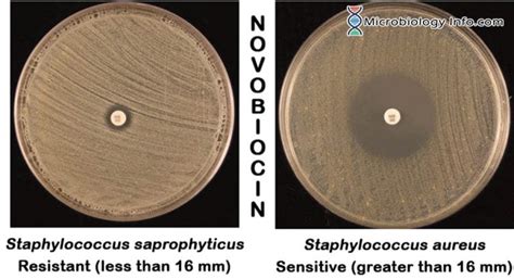 Novobiocin Susceptibility Test Procedure Uses And Interpretation