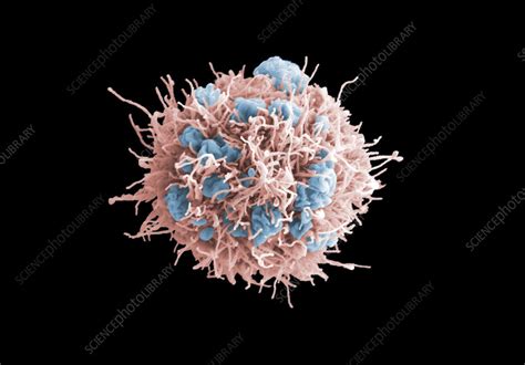 Cervical Cancer Cell Sem Stock Image C059 7494 Science Photo Library